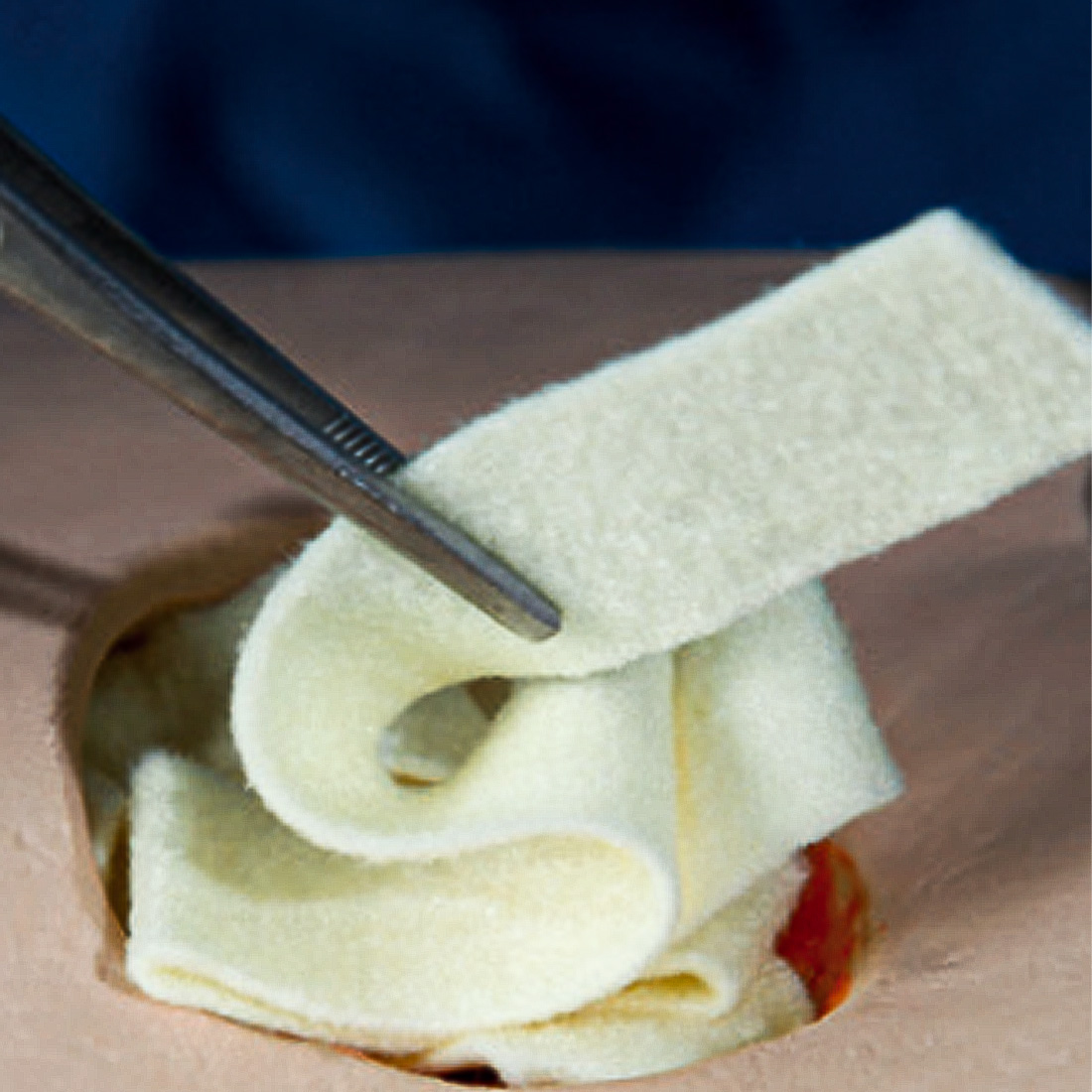 Curativo de Fibra Gelificante Antimicrobiano Exufiber ® Ag+ 2x45 ...